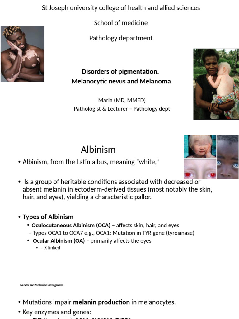 Disorders of Pigmentation | PDF | Skin | Diseases And Disorders
