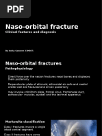 Ethmoid Bone - Location - Structure - Relationships - TeachMeAnatomy | PDF | Human Nose | Human ...