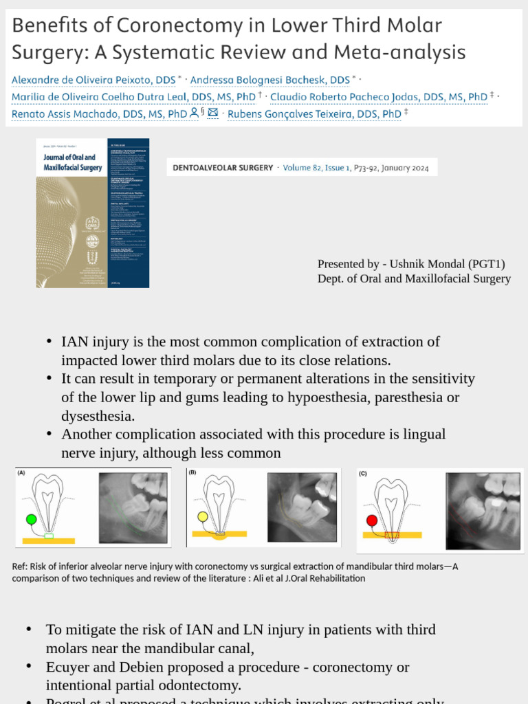 Benefits of Coronectomy | PDF | Dental Anatomy | Health Sciences