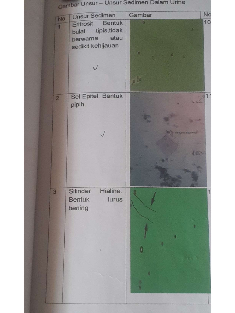 Unsur Sedimen Urin | PDF