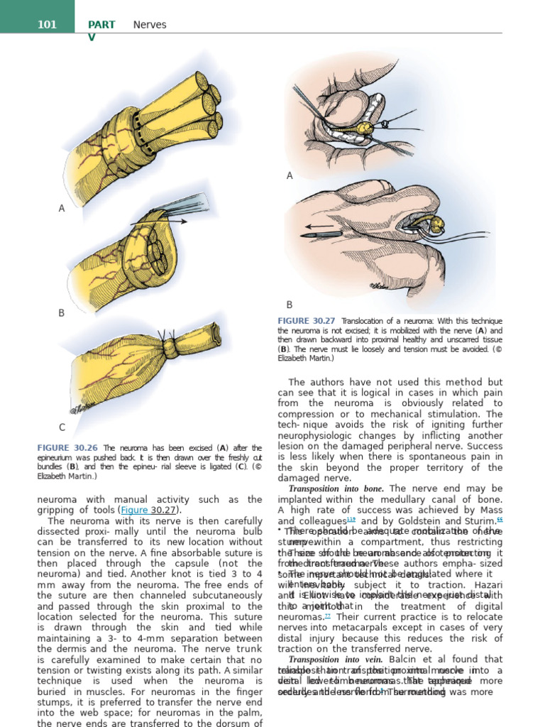 Greenx27s Operative Hand Surgery 7th Dragged PDF | PDF | Surgical ...