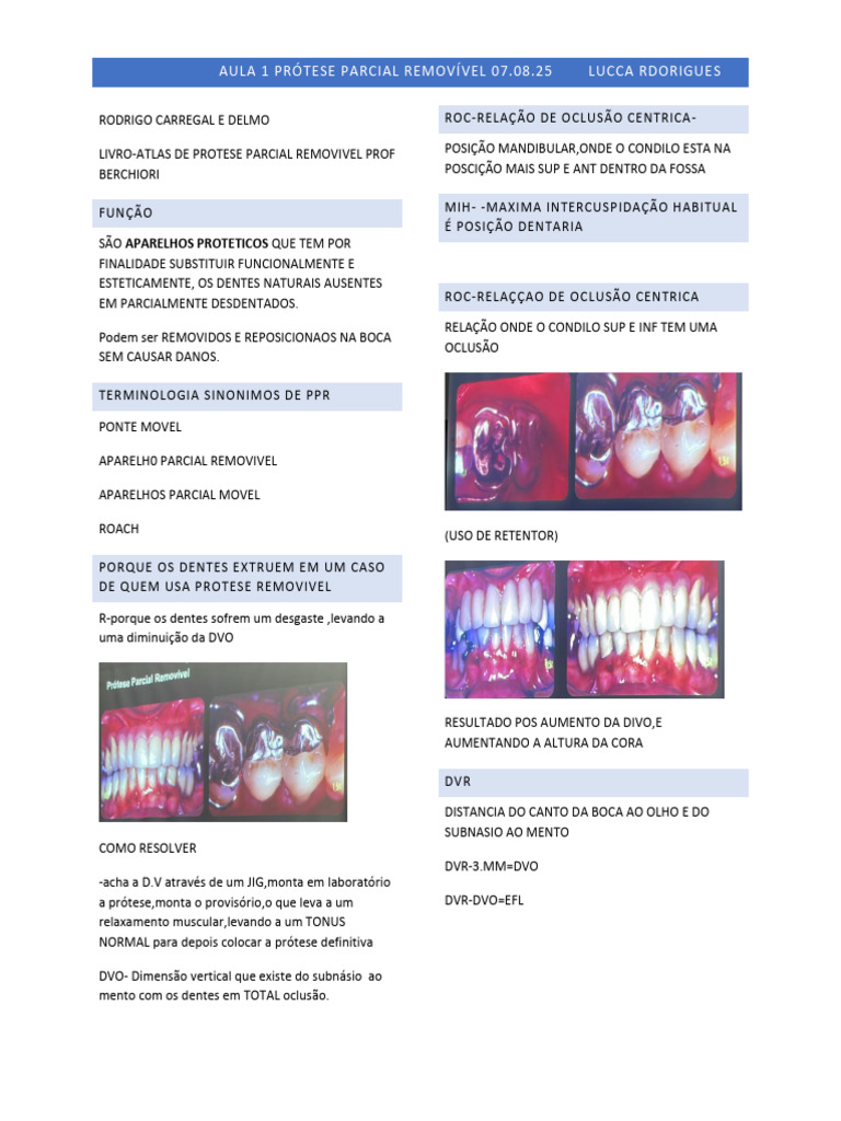 Definição e Classificação PPR | PDF | Dente humano | Prótese