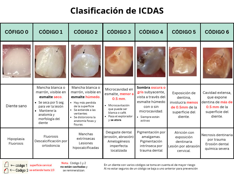 Clasificación ICDAS de Caries Dental | PDF | Esmalte de dientes | Diente