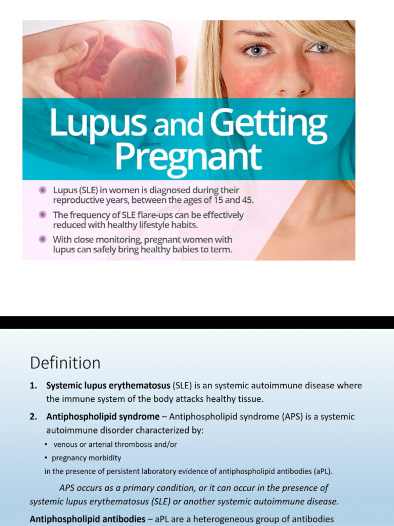 Systemic Lupus | PDF