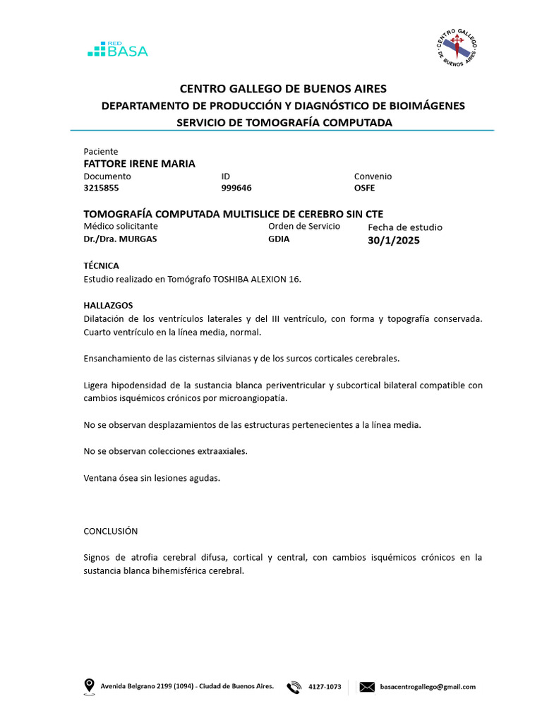 Fattore Irene Maria Cerebro Sctye | PDF