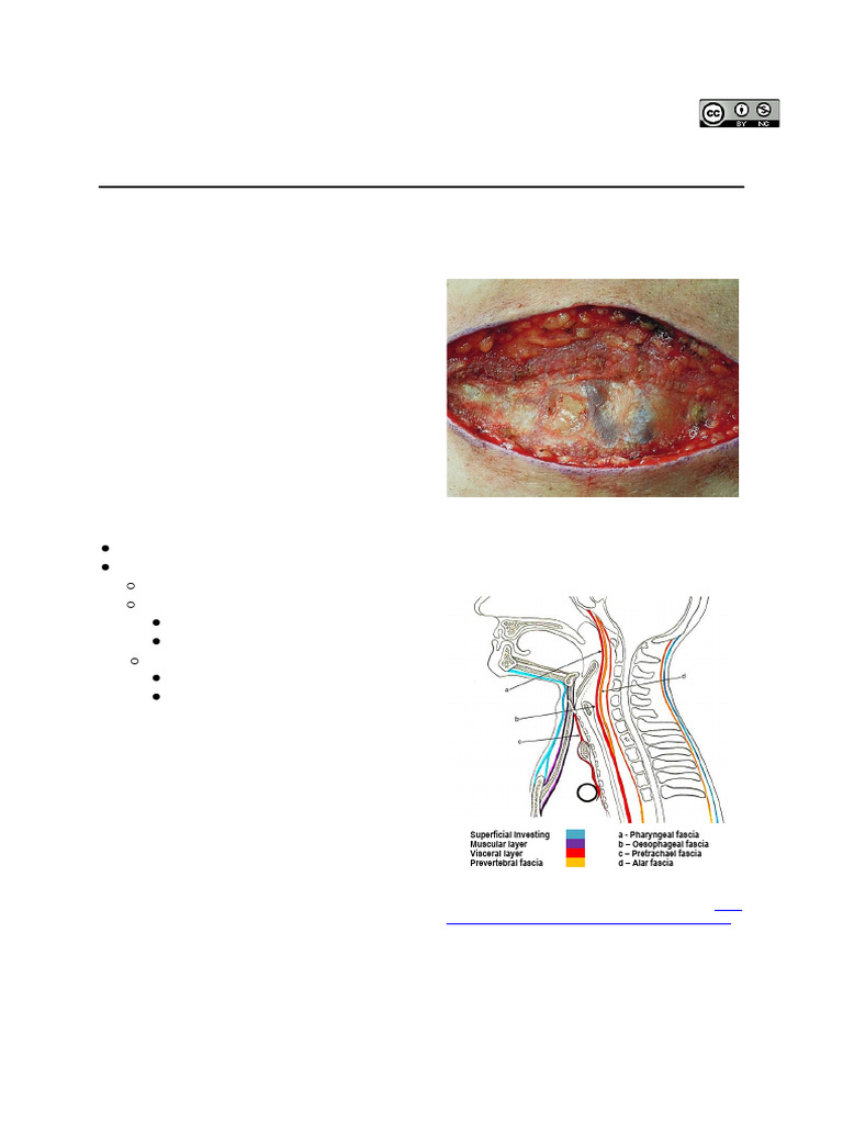 Drenaje Quirúrgico de Los Abscesos Cervicales | PDF | Anatomía humana ...