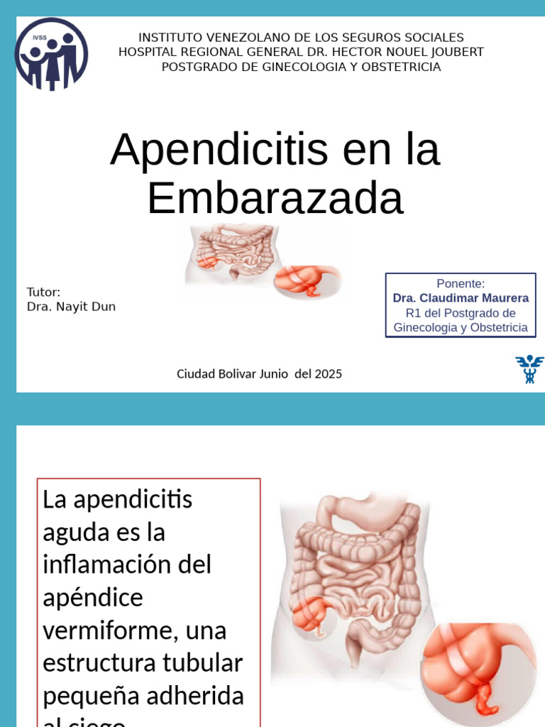 Apendicitis en El Embarazo | PDF | El embarazo | Especialidades Medicas