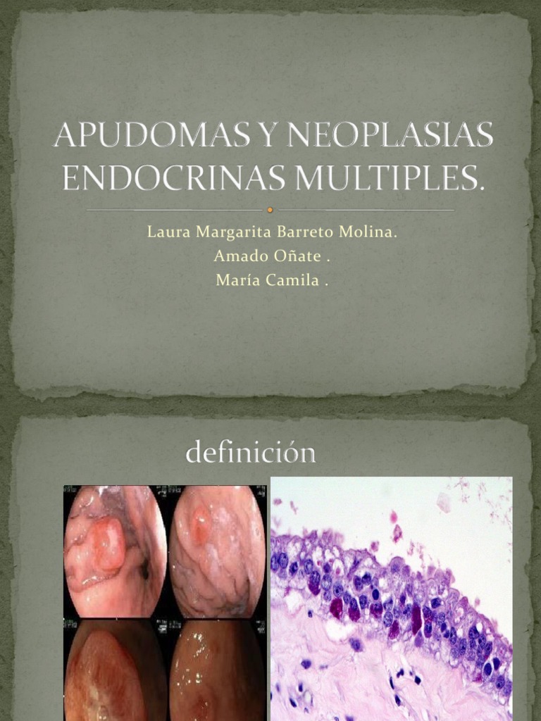 Apudomas y Neoplasias As Multiples | PDF