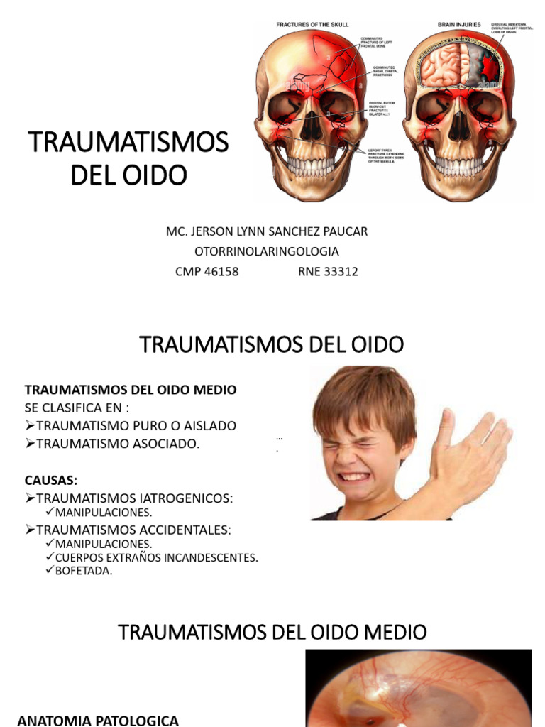 Traumatismos y lesiones del oído | PDF | Oído | Sentidos
