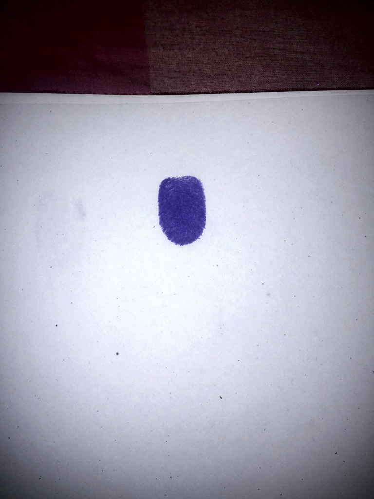 Left Thumb | PDF