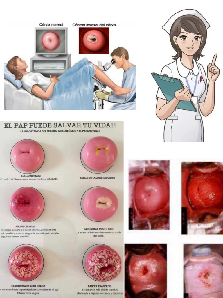 Imagenes Cacu | PDF