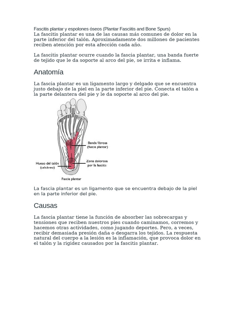 Fascitis Plantar y Espolones Óseos | PDF | Cirugía | Pie