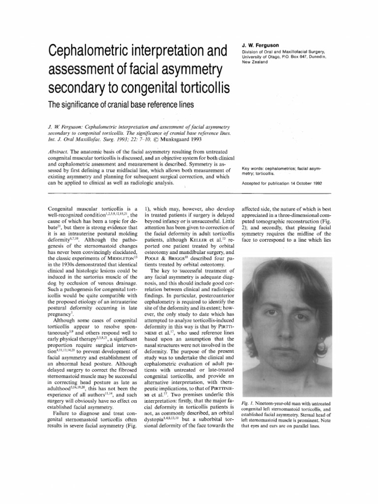 Facial Asymmetry from Torticollis Analysis | PDF