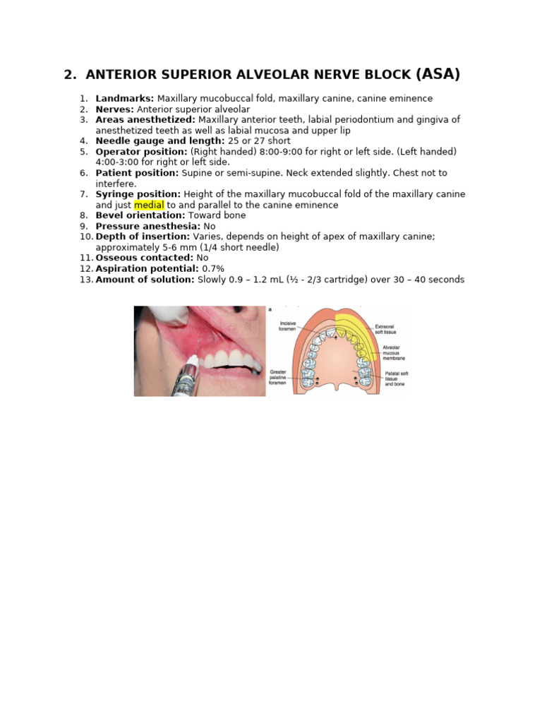 Asa Injection | PDF