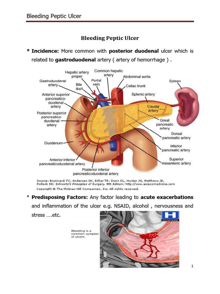 Management of Bleeding Peptic Ulcers | PDF | Bleeding | Endoscopy
