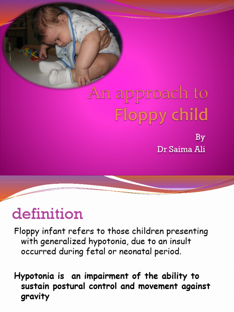 Floppy Infants and Muscular Dystrophy | PDF | Muscular Dystrophy ...