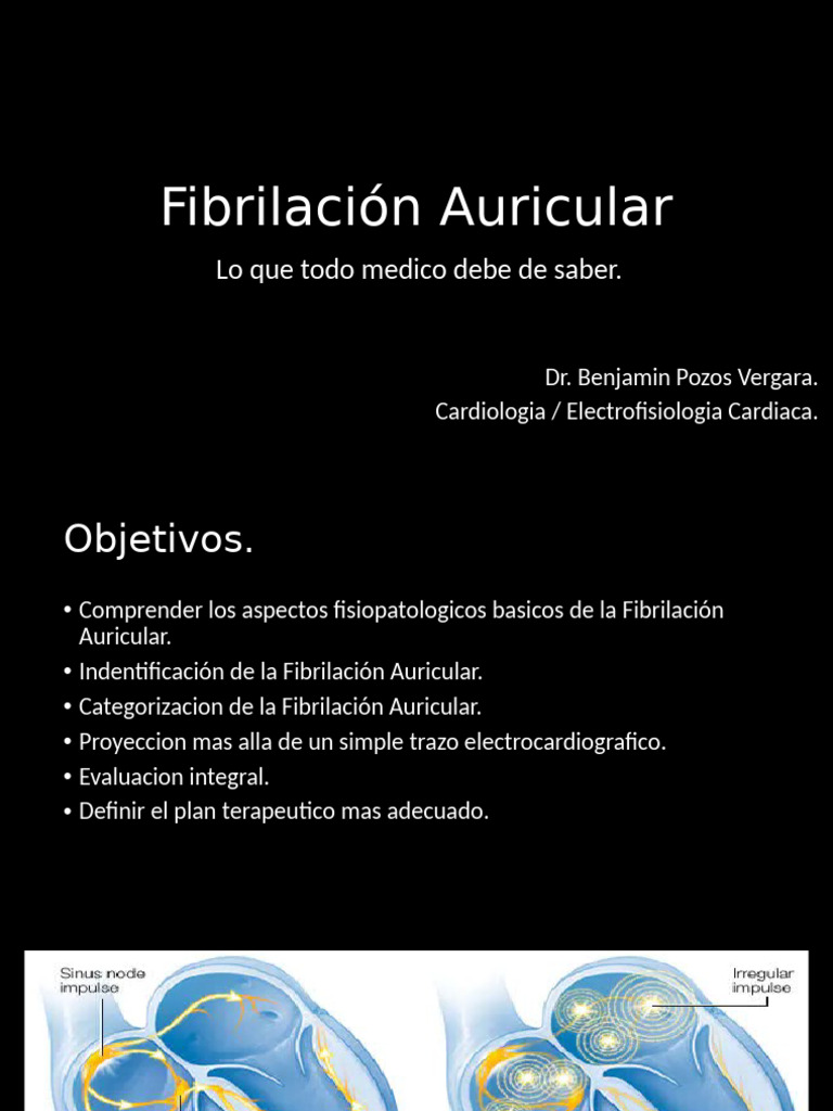 Fibrilacion Auricular | PDF | Arritmia cardiaca | Medicina Interna