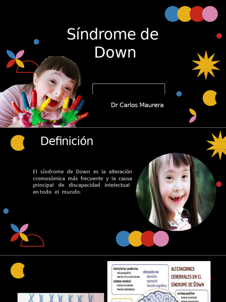 Sindrome Down | PDF | Síndrome de Down | Enfermedades y trastornos