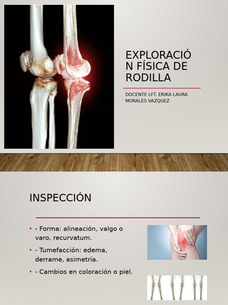 Exploracion Fisica Rodilla | PDF