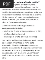 Proceso de Stieda y su tratamiento | PDF | Tobillo | Cirugía