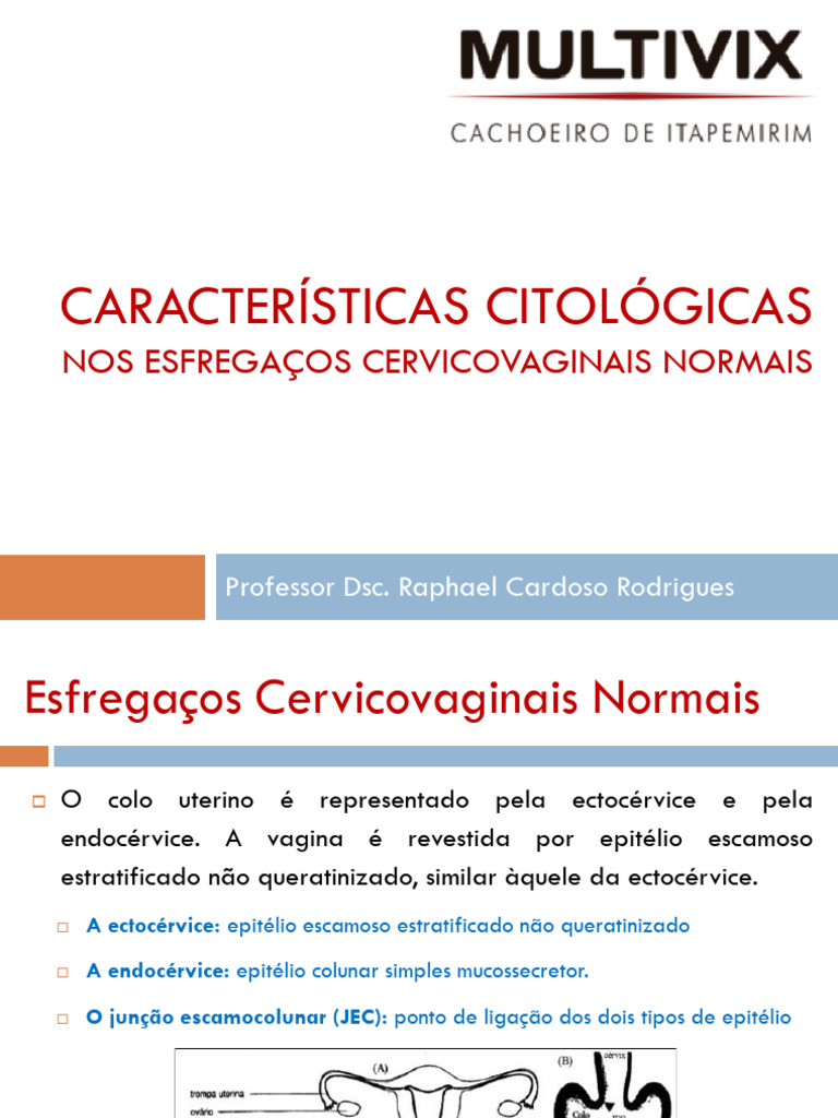 Aula 8 - Características Citológicas e ASC | PDF | Câncer cervical | Anatomia