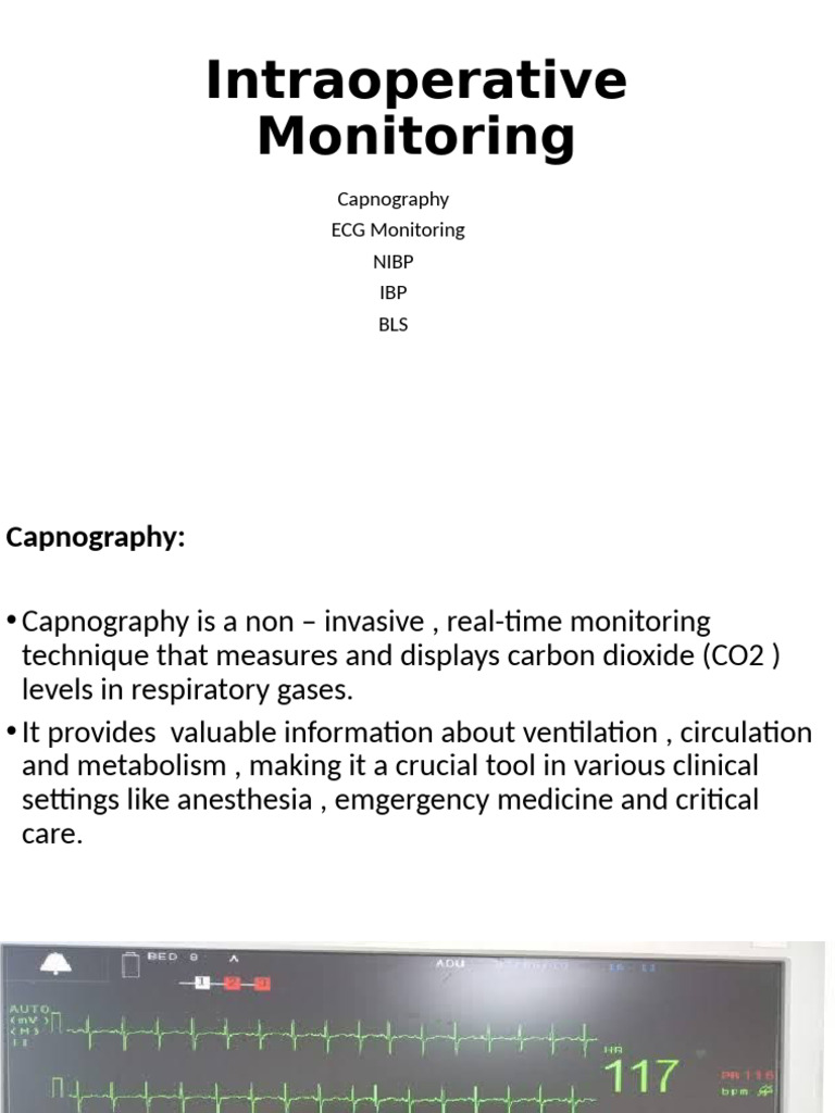 Intraoperative Monitoring Techniques Explained | PDF ...