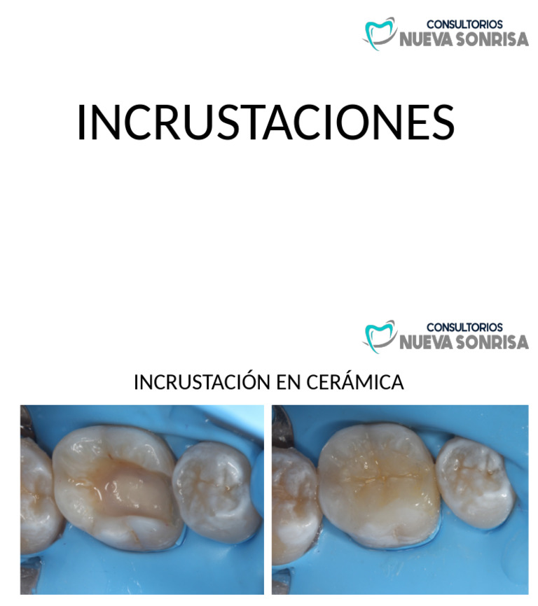 INCRUSTACION | PDF