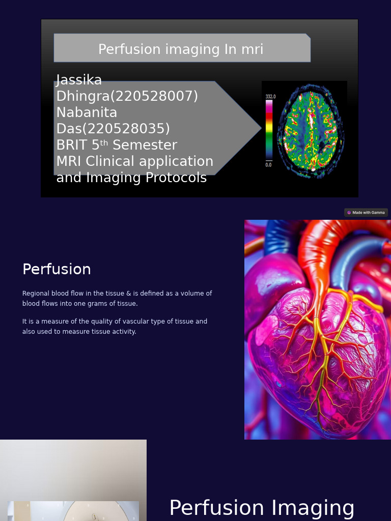 MRI Perfusion Imaging Overview | PDF | Magnetic Resonance Imaging ...