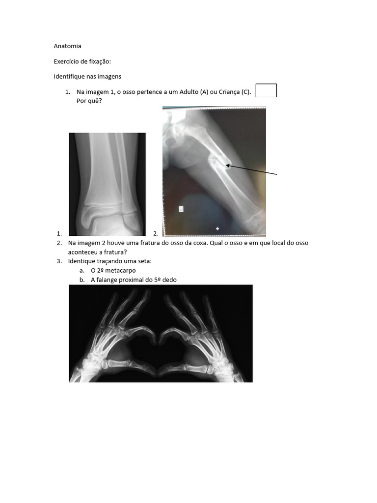 Anatomia Osteomioarticular Exerc Cio | PDF