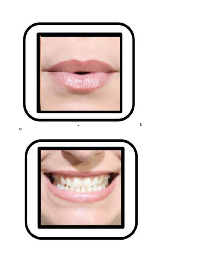 Fonemas Bilabiales (Boca) | PDF