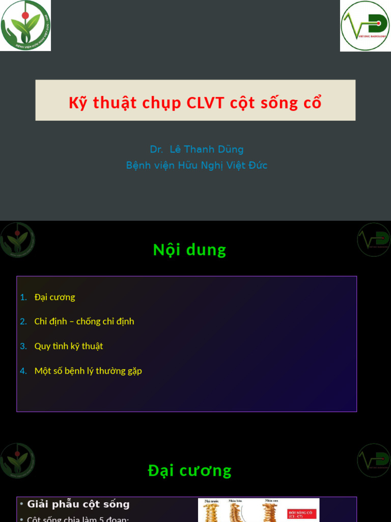 B3. CLVT cột sống cổ | PDF