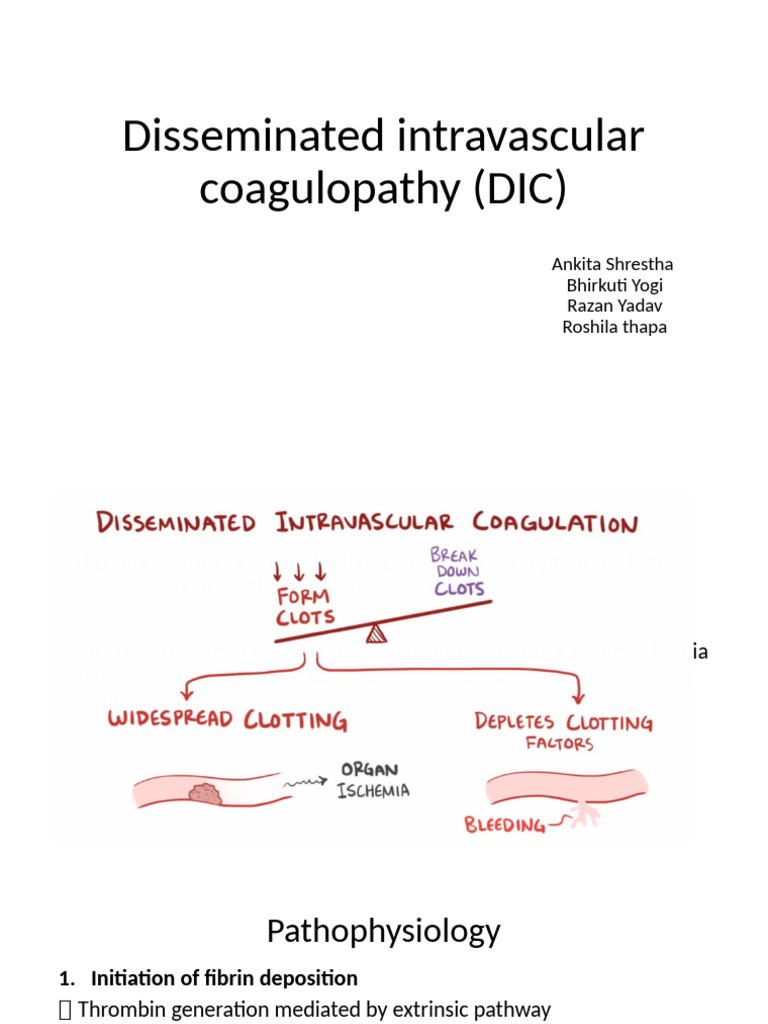 DIC: Pathophysiology and Treatment Guide | PDF | Coagulation | Platelet