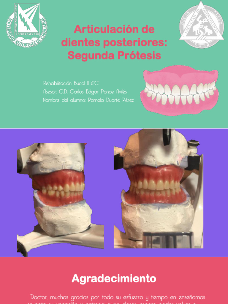Articulación de Dientes Posteriores Segunda Prótesis. | PDF