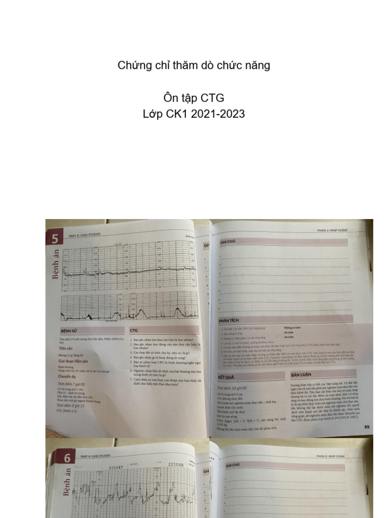 Ôn Tập CTG | PDF