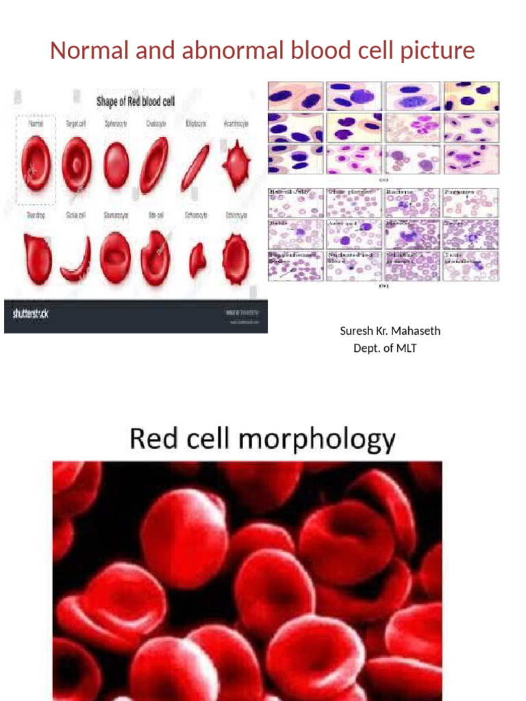 Normal and Abnormal Blood Cell Picture. | PDF