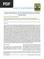 Atrial Fibrillation:Flutter in Pre-Excitation - LITFL - ECG Library ...