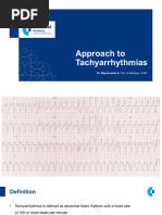 Atrial Fibrillation:Flutter in Pre-Excitation - LITFL - ECG Library ...