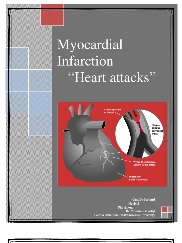 Myocardial Infarction "Heart Attacks" | Download Free PDF ...