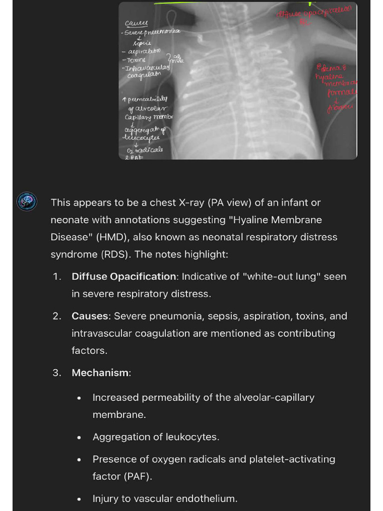 Pediatrics X-rays | PDF
