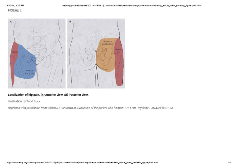 HIP Pain Area 1 | PDF