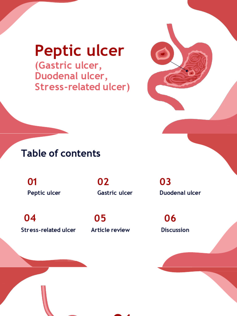 Peptic Ulcer | PDF
