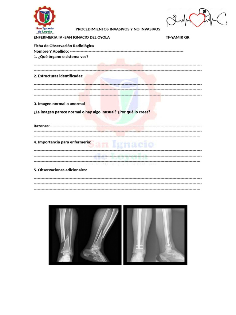 Procedimientos Invasivos y No Invasivos | PDF