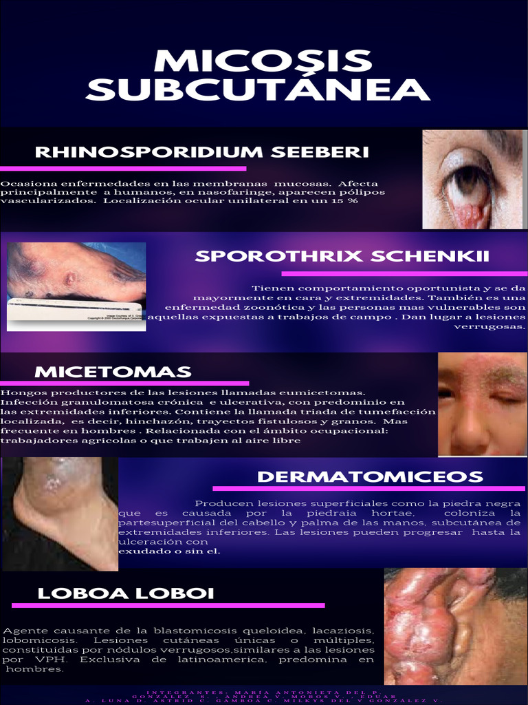 Micosis Subcutánea | PDF
