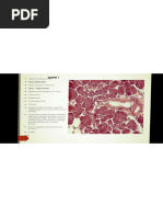Kennedy Class 3 Modification Overview | PDF | Prosthodontics | Dentures