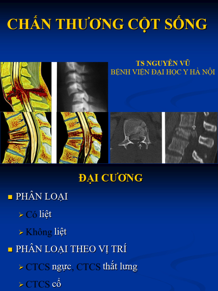 Lec13. s3.3 - Slide Lms | PDF