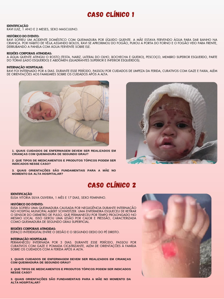 LPP E FERIDAS EM PEDIATRIA.pdf 2 | PDF