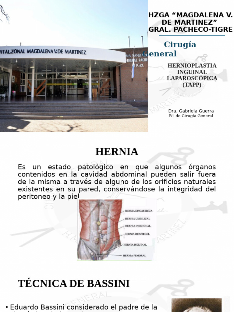 Hernioplastia Inguinal Laparoscópica (TAPP) - R1 Guerra Gabriela | PDF | Especialidades Medicas