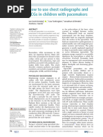 Precautions Taken With Pacemaker Patients Using Ultrasonic Scaler | PDF ...