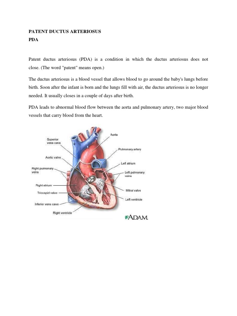Patent Ductus Arteriosus | PDF | Aorta | Heart