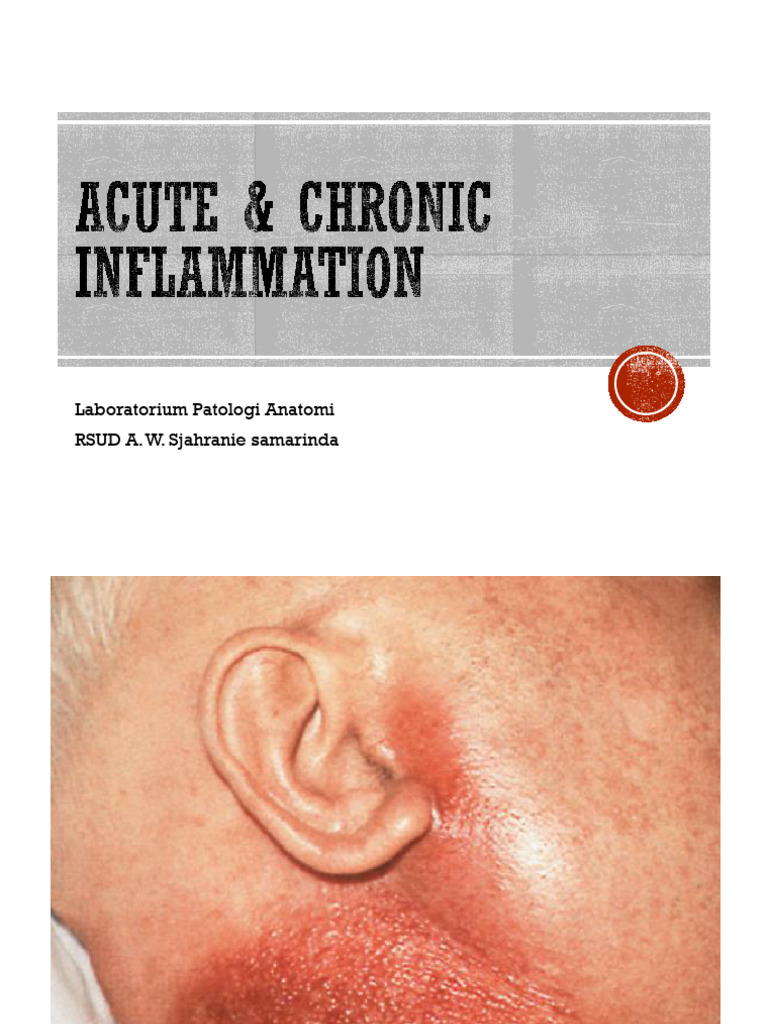 Patofisiologi Radang Akut Dan Kronis 3 | PDF